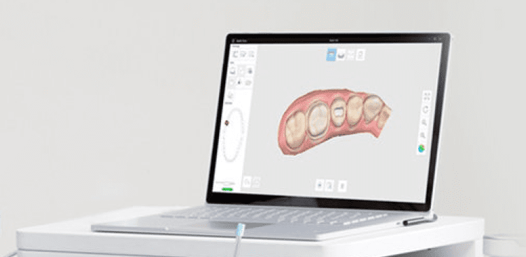 Medit i500 IO Scanner- Image and Produce Open Source STL, OBJ, and PLY ...