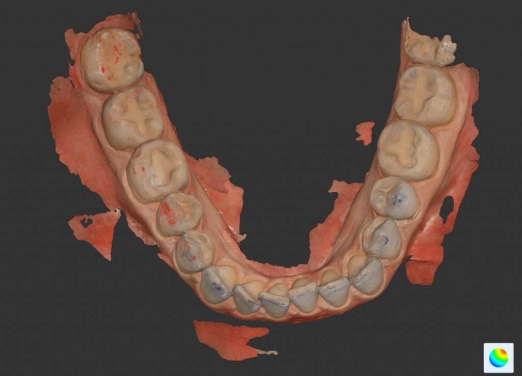 lower arch | CAD-Ray.com