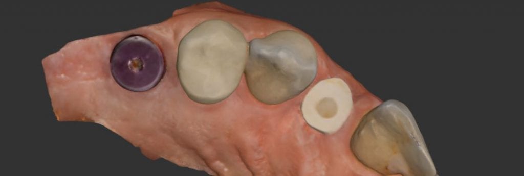 Medit i500 IO Scanner- Image and Produce Open Source STL, OBJ, and PLY ...