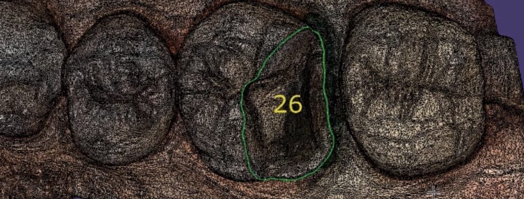Medit i500 IO Scanner- Image and Produce Open Source STL, OBJ, and PLY ...