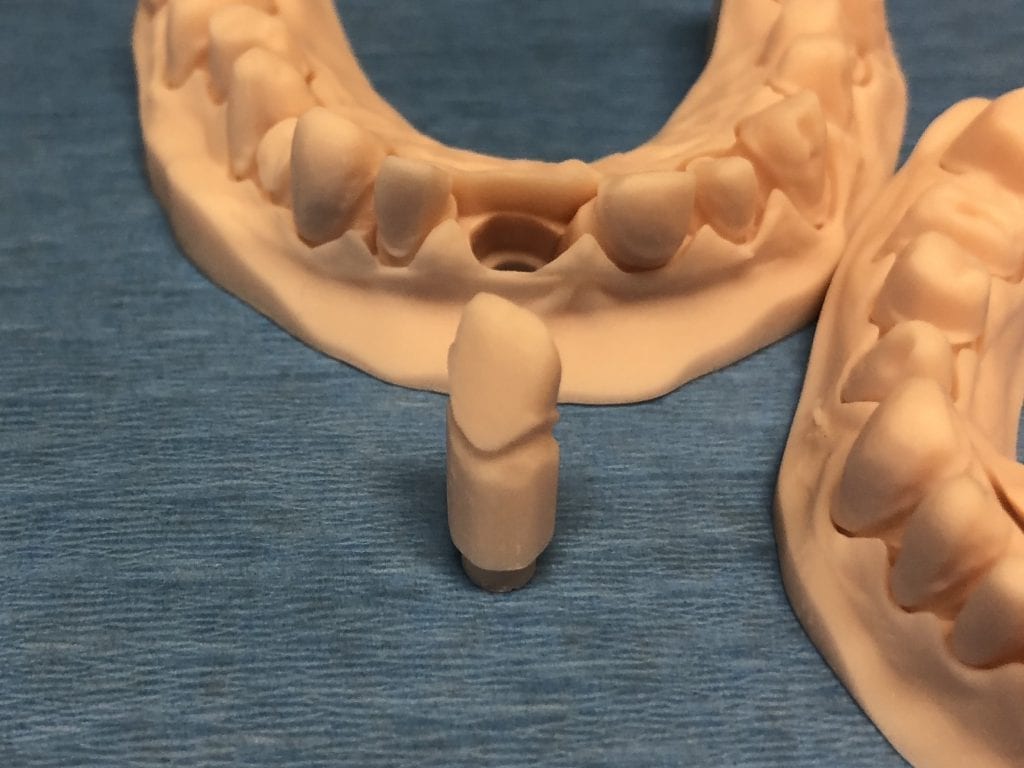 Medit i500 IO Scanner- Image and Produce Open Source STL, OBJ, and PLY ...