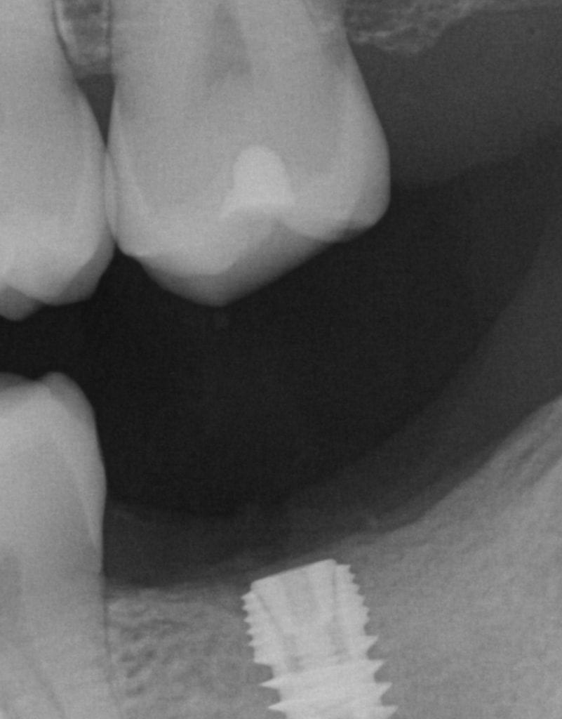 pot op x-ray | CAD-Ray.com