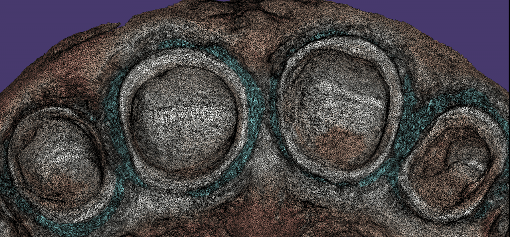 Four Unit Anterior eMax Bridge with Medit i500, exocad, and Z4 Milling ...