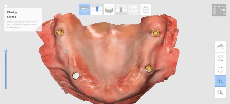 How to Scan an Edentulous Arch in 90 Seconds with the Medit i500 Intra-Oral Scanner | CAD-Ray.com
