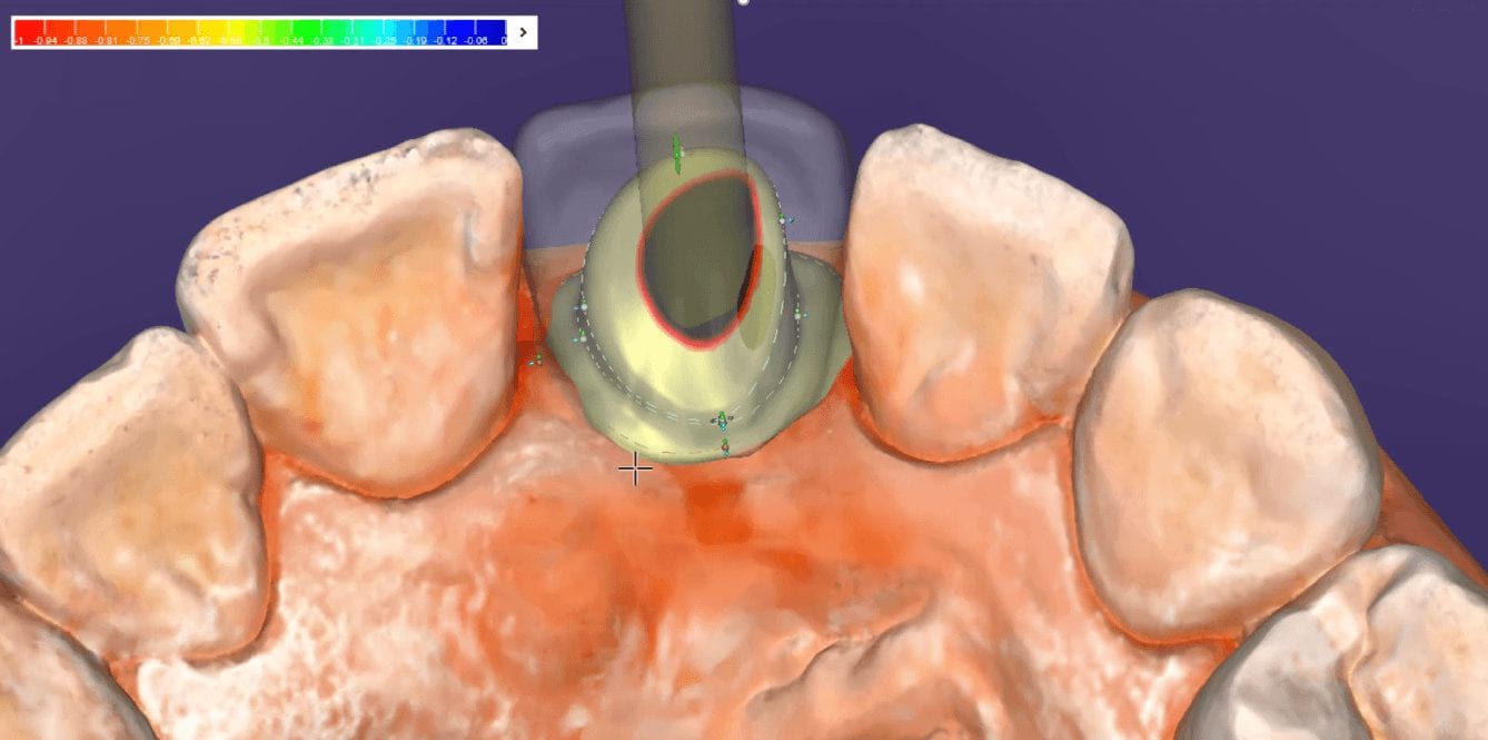 Clinical App - Orthodontic Planner | CAD-Ray.com