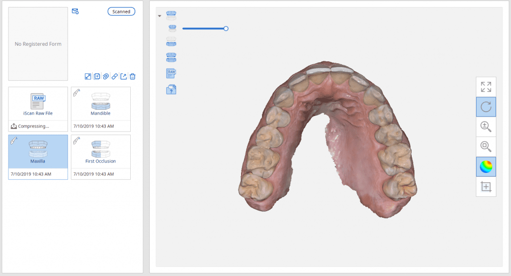 full arch imaging for clear aligner therapy by medit i500 | CAD-Ray.com