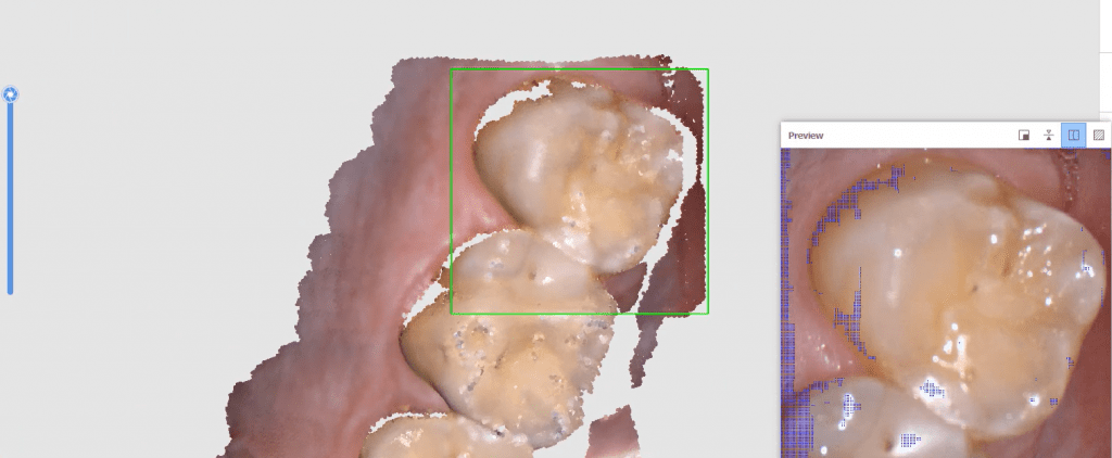 full arch imaging with the medit i500 scanner | CAD-Ray.com