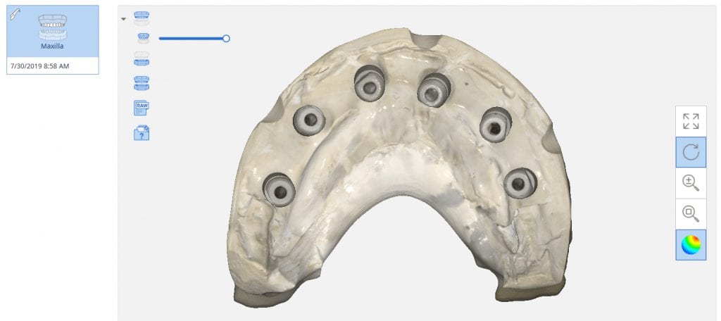 full arch scan bodies | CAD-Ray.com