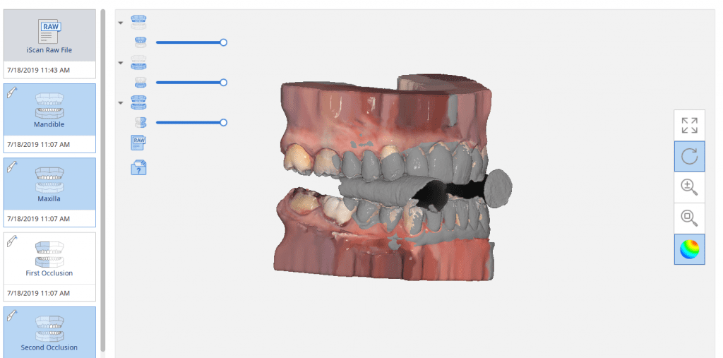 second bite | CAD-Ray.com