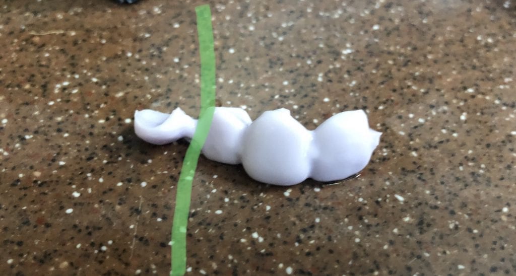 Three Unit Bridge and A Single Unit Veneer Milled with 40 mm Emax Block ...