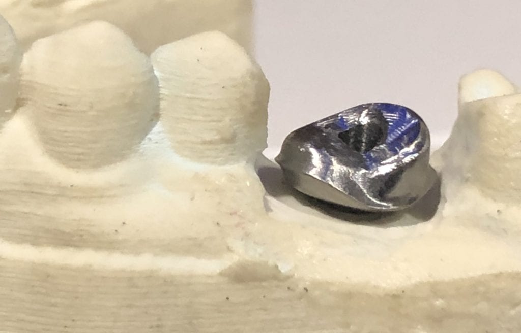 Custom Abutment And Crown Designs Milled With Multiple Milling Machines ...