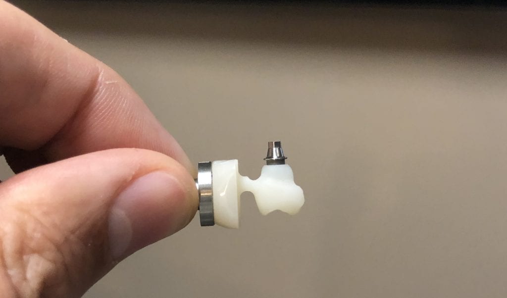 Problems Milling to a Tibase From a Scanbody Digital Impression ? | CAD ...