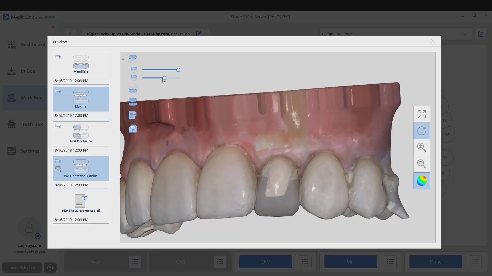 Digital Copy Milling (Anatomic Wax Up) Vs. Scan Pre-Op Model | CAD-Ray.com