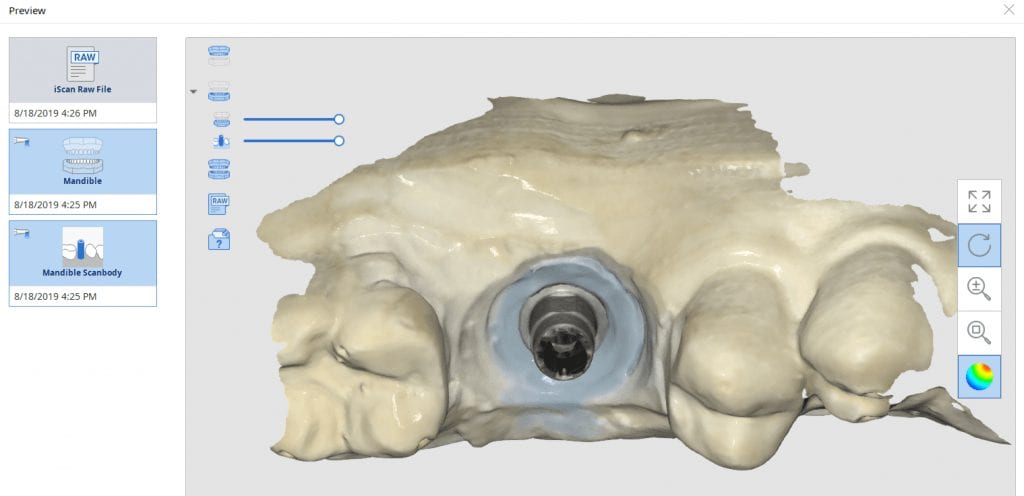 first postion of 16005 | CAD-Ray.com