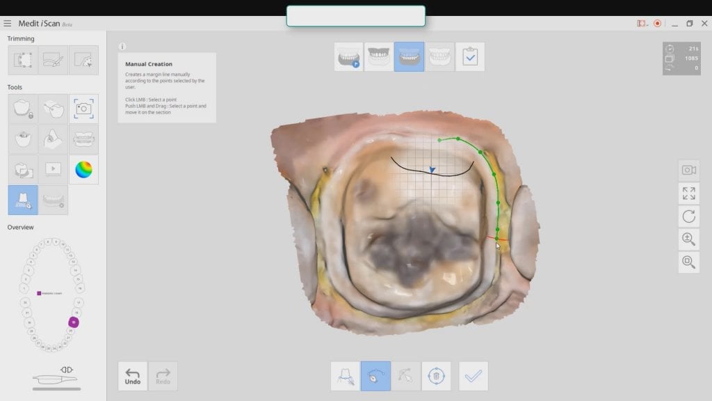 draw-margin-line-step-2-mp4-1 | CAD-Ray.com
