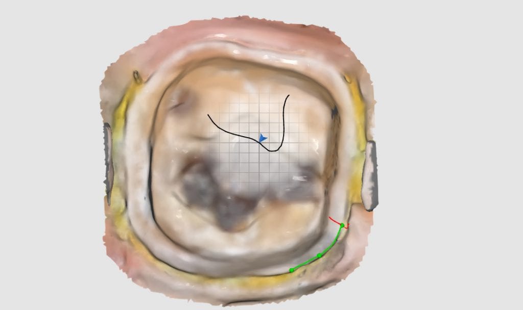 margin line drawing | CAD-Ray.com
