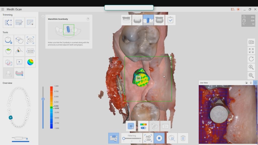 Implant Scanbody Identification Mp4 1 Cad Ray