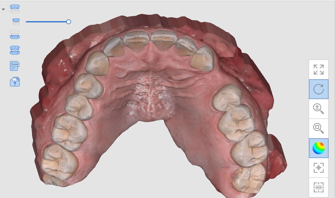 Full Arch Scans With Multiple Variables | CAD-Ray.com