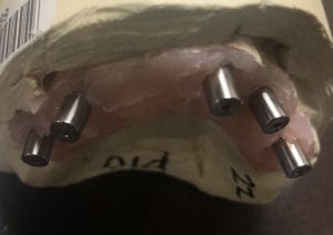 Imetric ICam 4D Photogrammetry Meets the Artificial Intelligence ...