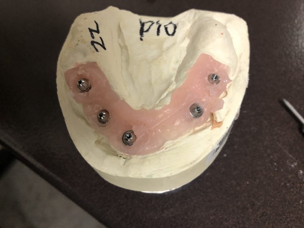 Imetric ICam 4D Photogrammetry Meets the Artificial Intelligence ...