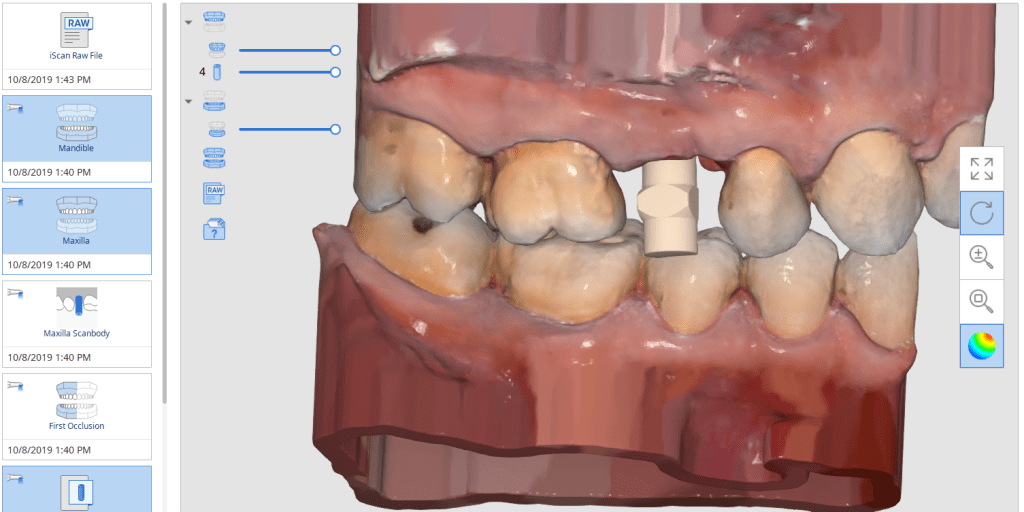 scanbody | CAD-Ray.com