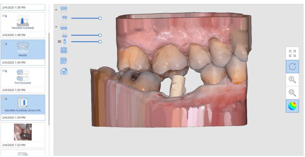 implant design | CAD-Ray.com