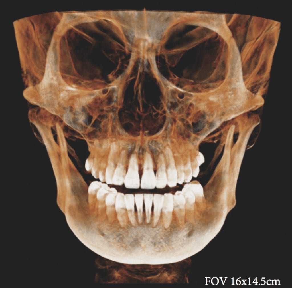 HDX WILL ECO-X CBCT Machine 16x9 FOV Call for Price | CAD-Ray.com