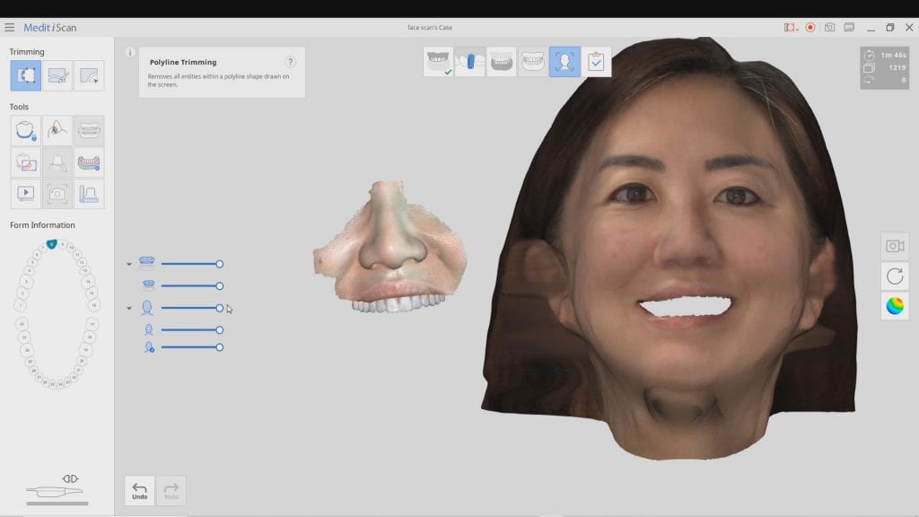 Face Scan With Medit i500 | CAD-Ray.com
