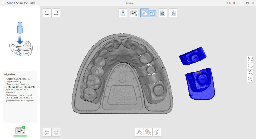 Medit T-710 Tabletop Scanner for Labs and Dentists | CAD-Ray.com