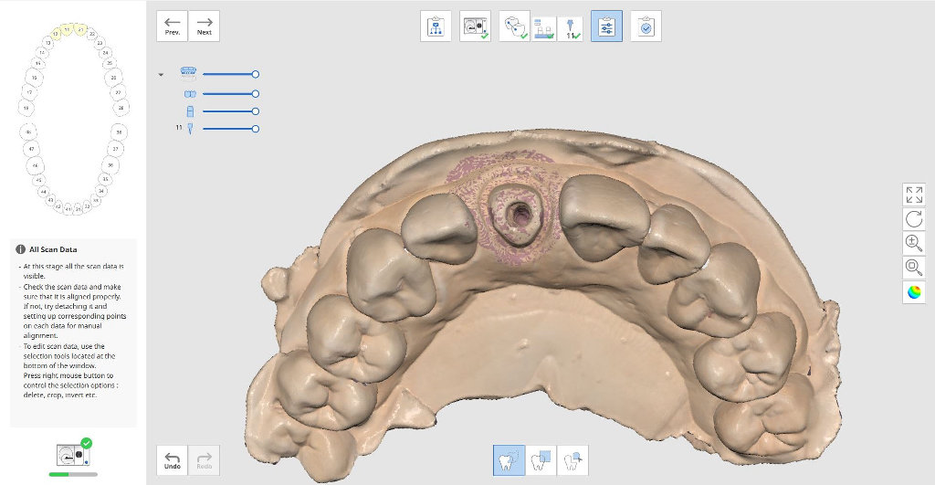 Medit T-710 Tabletop Scanner for Labs and Dentists | CAD-Ray.com