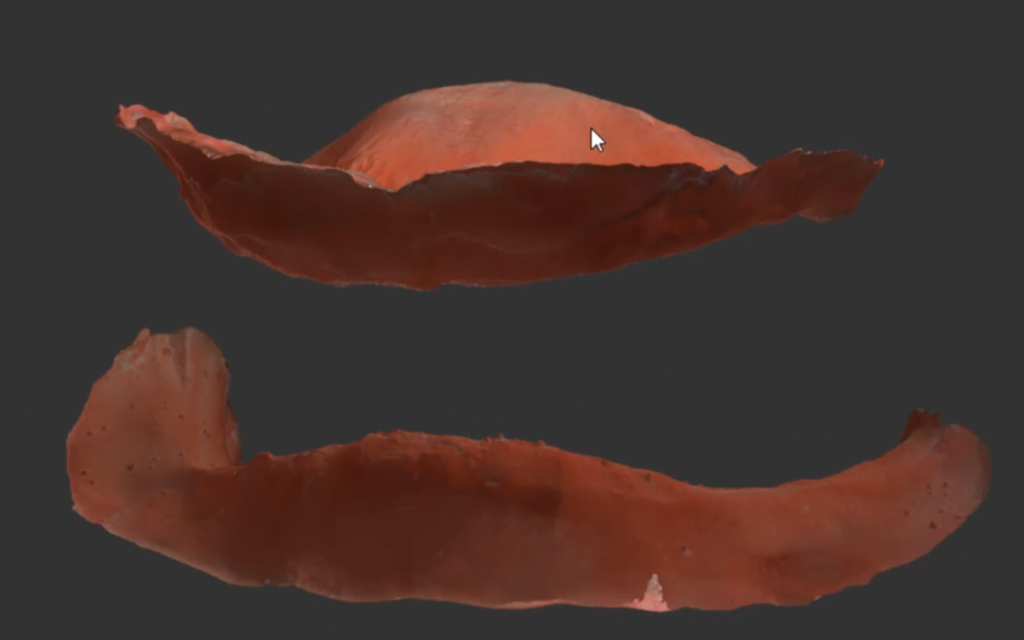 The CAD-Ray Protocol with Photogrammetry (ICam4d) and IOS (Medit i500 ...