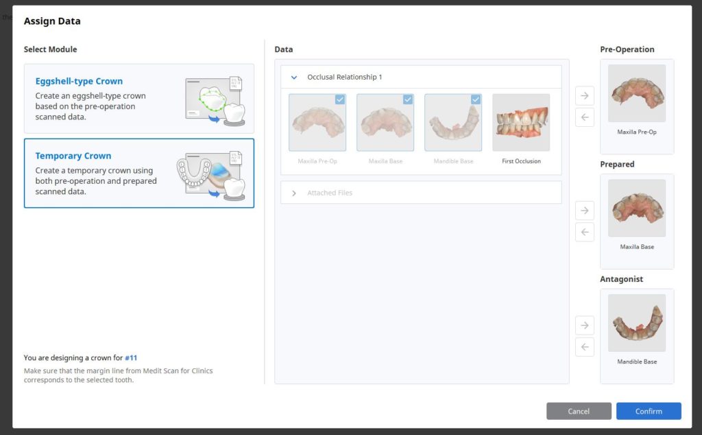 temp crown app | CAD-Ray.com