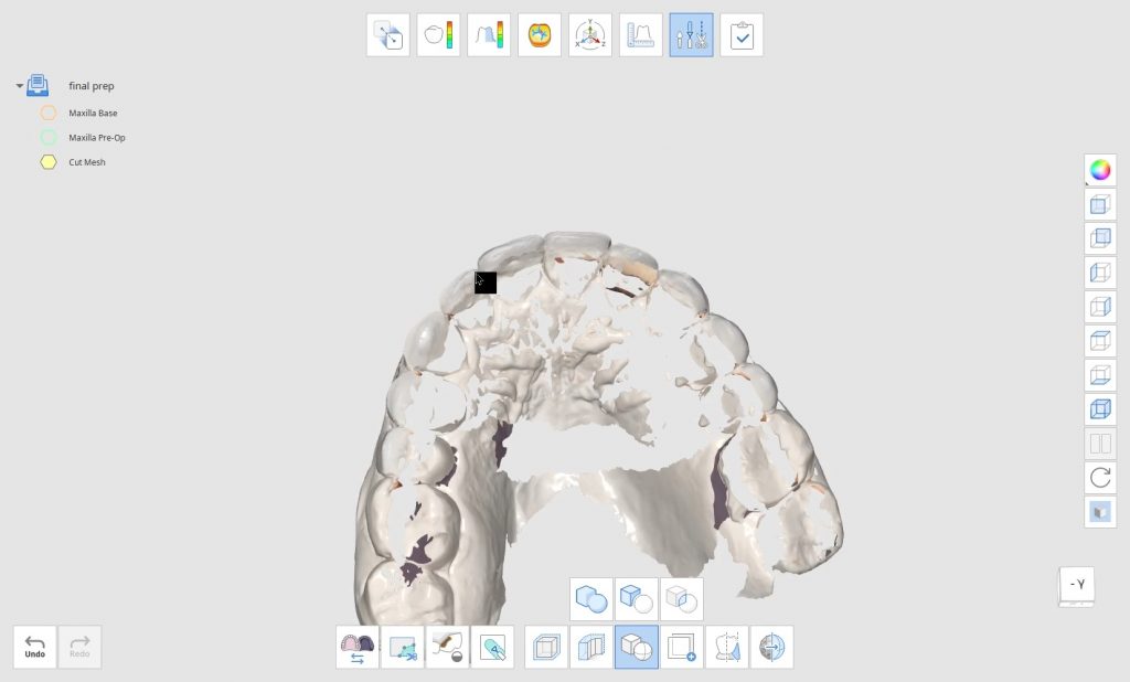 Digital Impressions Archives | CAD-Ray.com