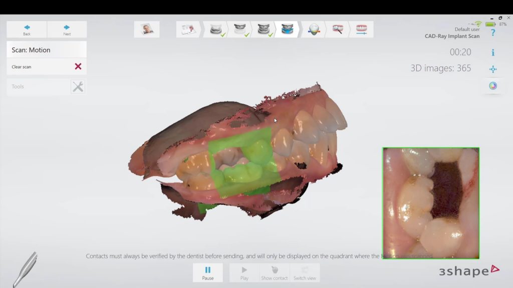 3shape automate for Trios Users - Milling or Printing has never been ...