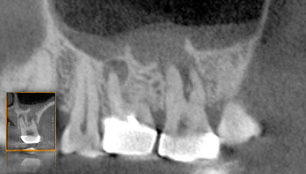 CAD-Ray Digital Dentistry Study Club | CAD-Ray.com