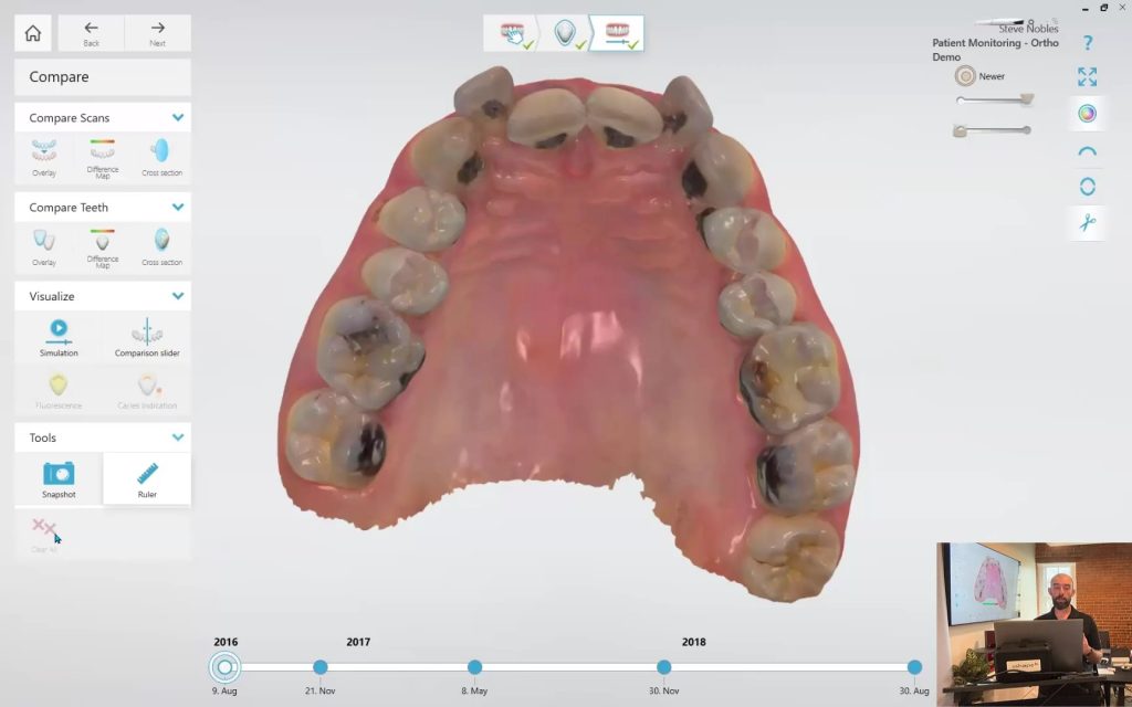 Patient Monitoring | CAD-Ray.com