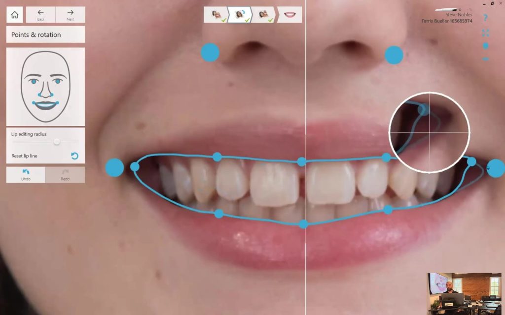 Smile Design | CAD-Ray.com