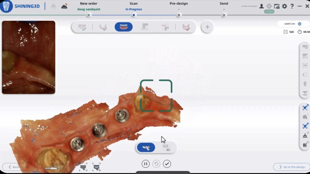 Shining3D Aoralscan Elite IOS + Intraoral Photogrammetry | CAD-Ray.com